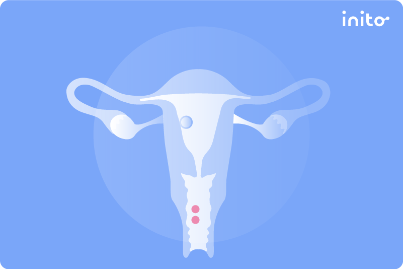 What to know if you think you’ve bruised your cervix - Inito