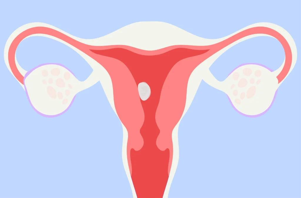 How Common is a Missed Miscarriage? Signs, Causes & Support